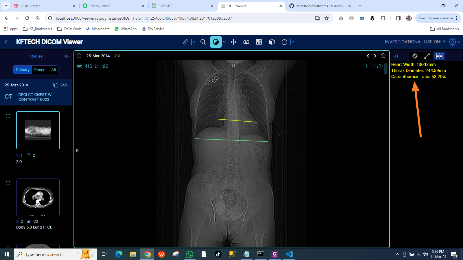 OHIF DICOM Viewer | Legiit