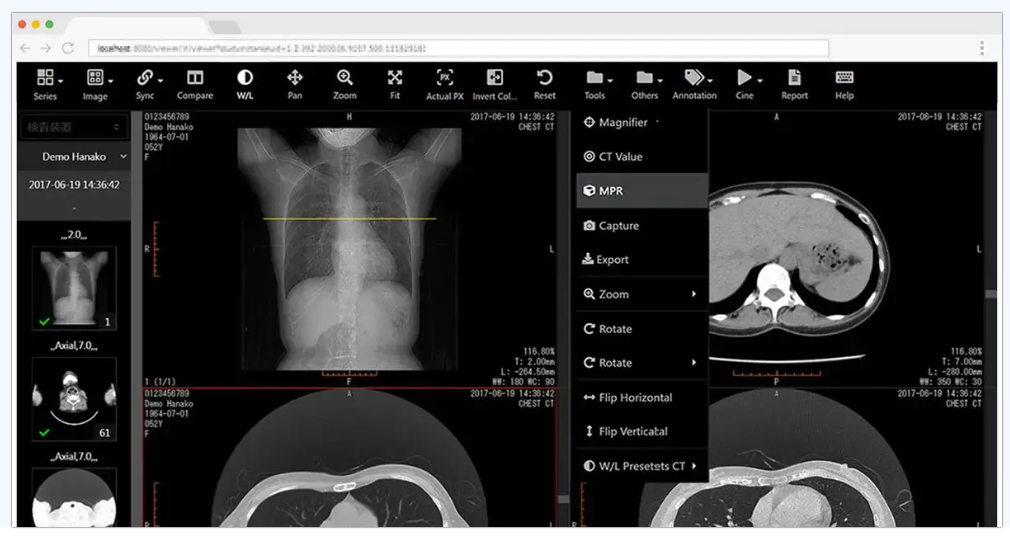 Ohif Dicom Viewer Legiit 